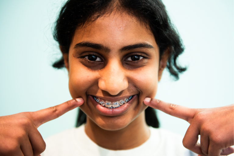 How to Fix an Overbite | Ortho Co.